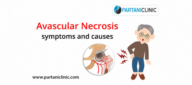 Avascular necrosis: diagnosis and treatment | Partani Clinic