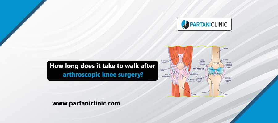 How long does it take to walk after knee arthroscopy surgery?