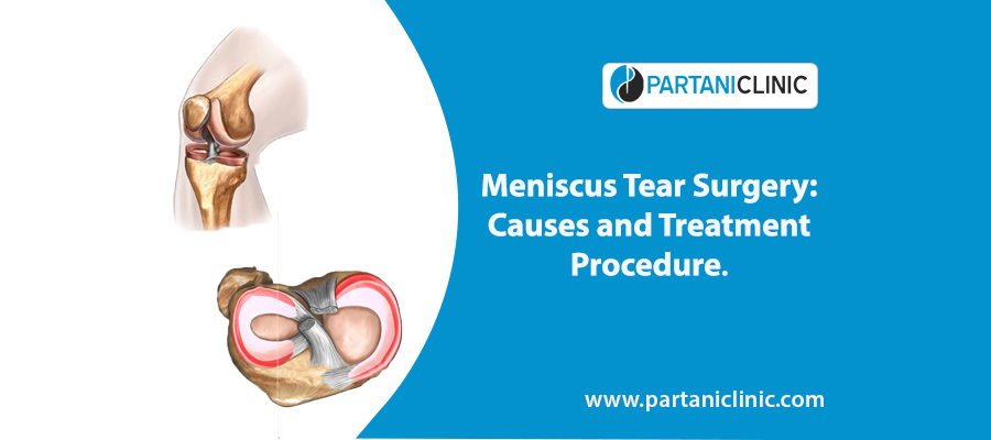 Meniscus Tear Surgery Causes & Treatment Procedure | Dr. Arun Partani
