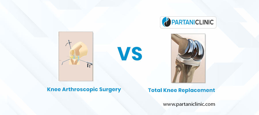 Knee Arthroscopic vs Knee Replacement in [2022] | Advice from a Surgeon