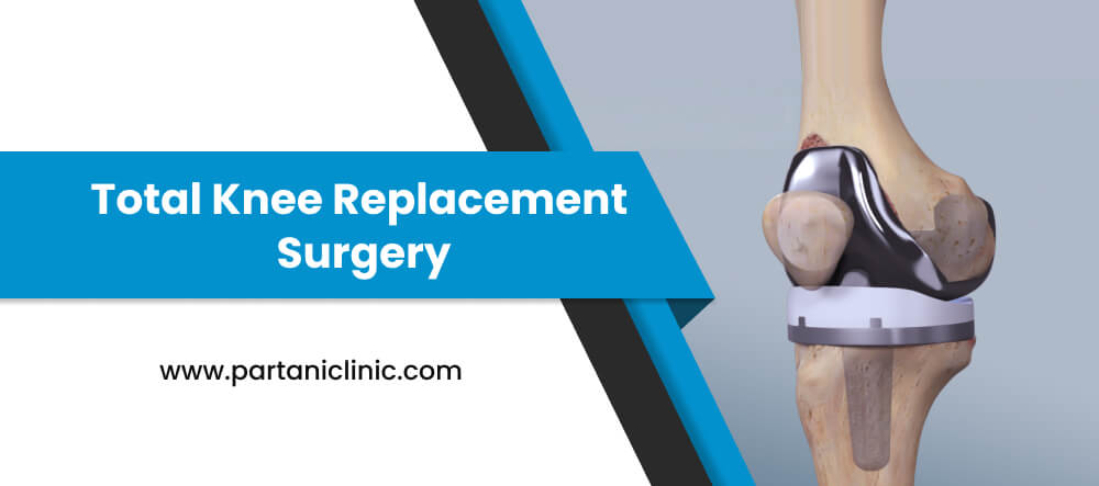 Total Knee Replacement Surgery in Jaipur | TKR Surgery - Dr. Arun Partani