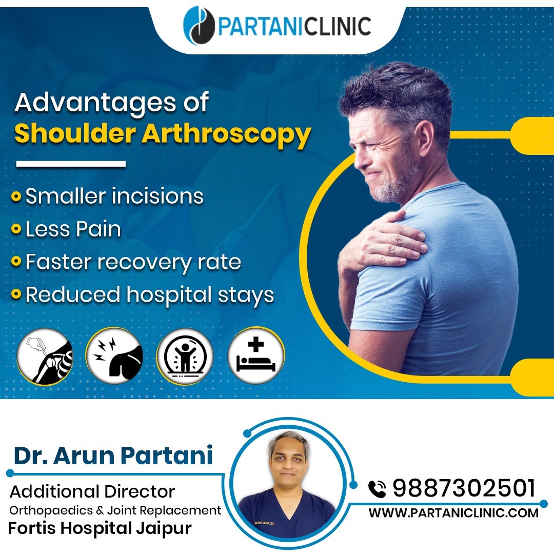 Advantages of Shoulder Arthroscopy - Dr. Arun Partani | Partani Clinic