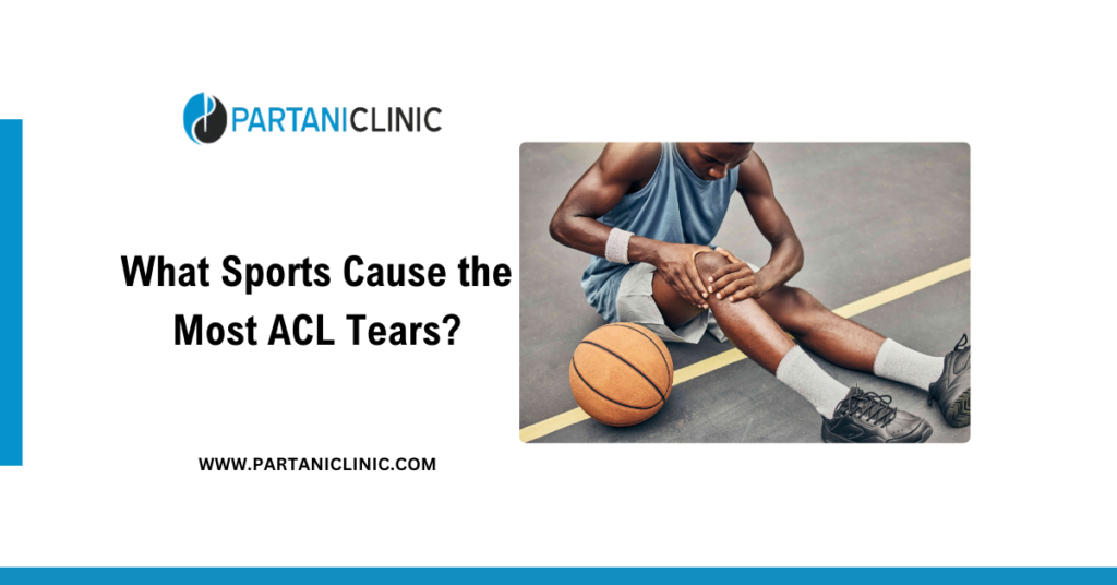 What Sports Cause the Most ACL Tears? | Partani Clinic