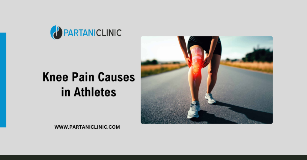Knee Pain Causes in Athletes - Quick Guide By Dr. Arun Partani
