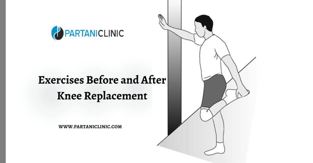 Exercises Before and After Knee Replacement - Partani Clinic