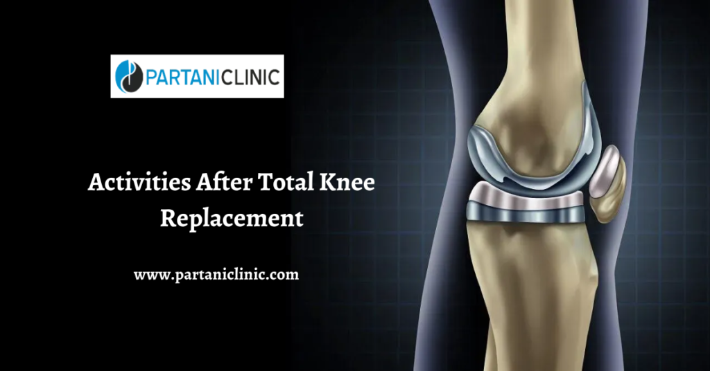 Activities After Total Knee Replacement: A Comprehensive Guide