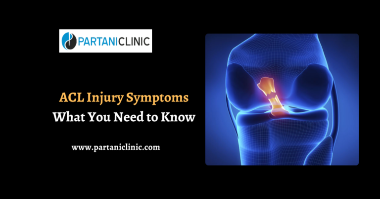 ACL Injury Symptoms: What You Need to Know | Partani Clinic