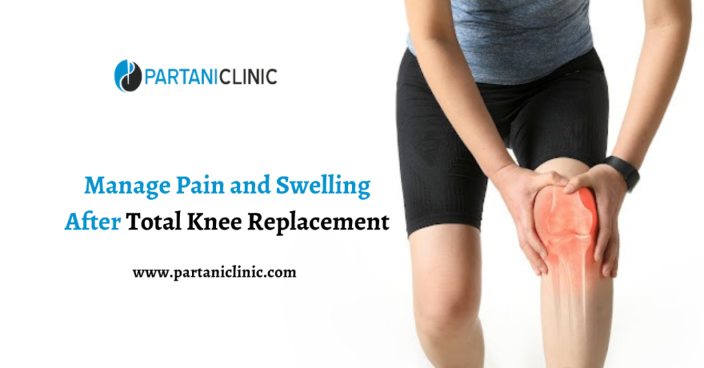 How to Manage Pain and Swelling After Total Knee Replacement Surgery?
