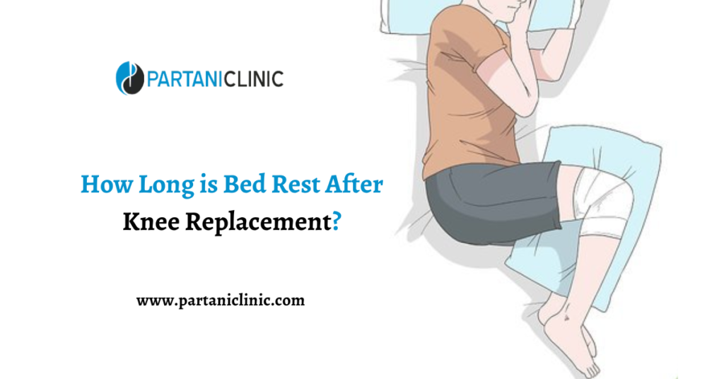 How Long is Bed Rest After Knee Replacement? | Partani Clinic
