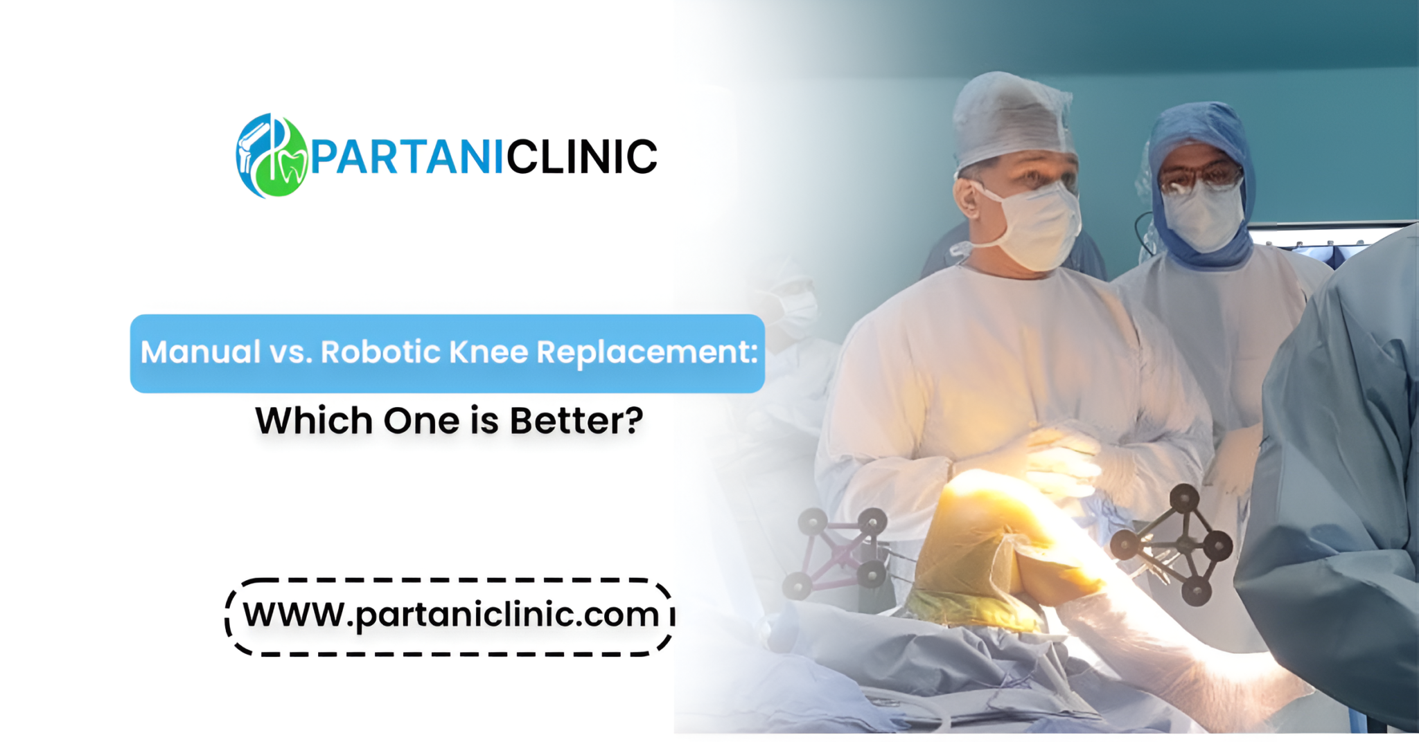 Manual Vs Robotic Knee Replacement Which One Should You Choose 4672