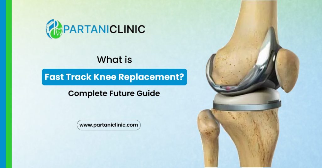 What is Fast Track Knee Replacement | Complete Future Guide