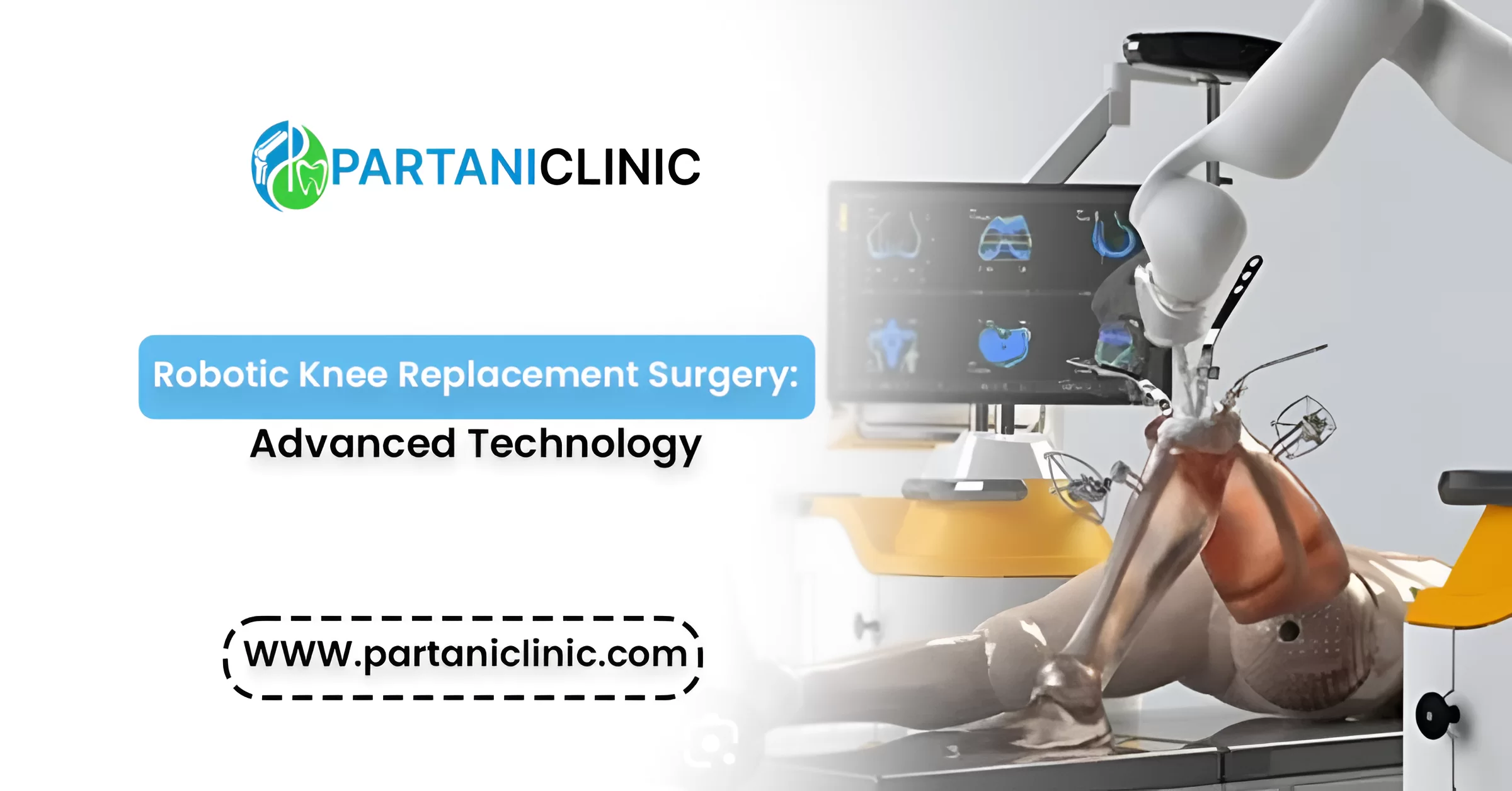 Robotic Knee Replacement Surgery in Jaipur Advanced Technology